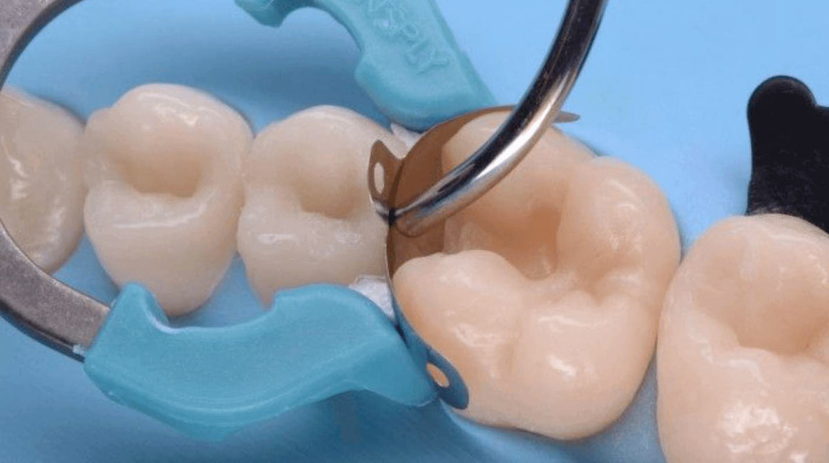 Matrix materials – Oral Health Supply